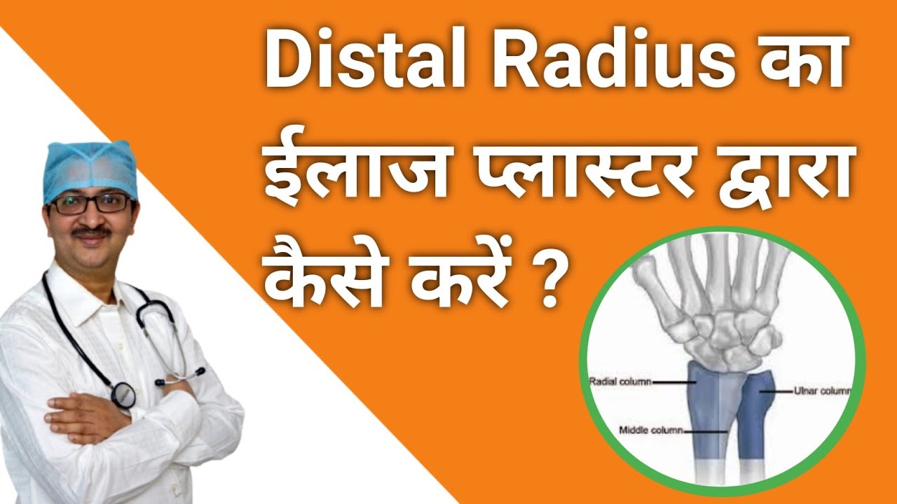 How to treat fracture distal radius by plaster and it's result #knee ...