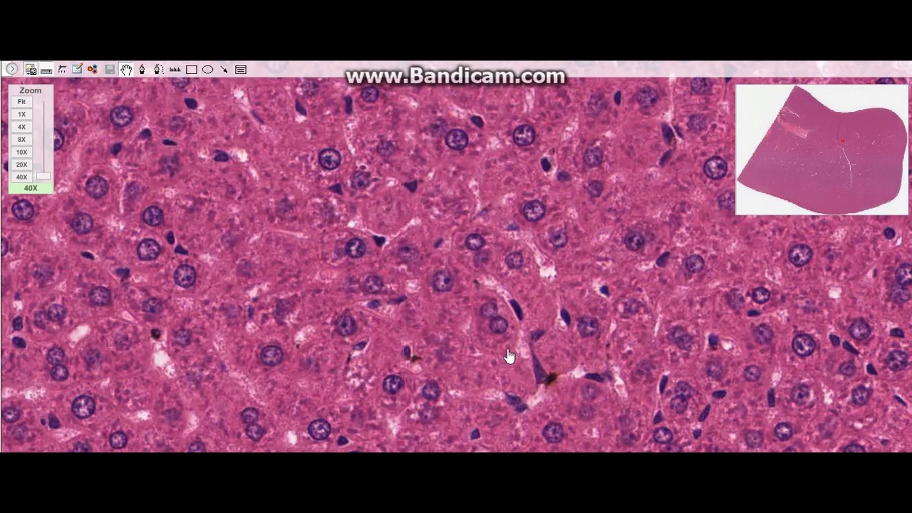 Histology Of The Liver Sinusoidal Lining Cells - YouTube