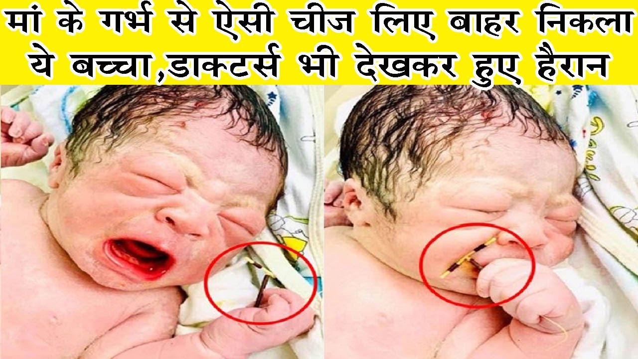 Baby born holding failed contraceptive coil in Vietnam - YouTube