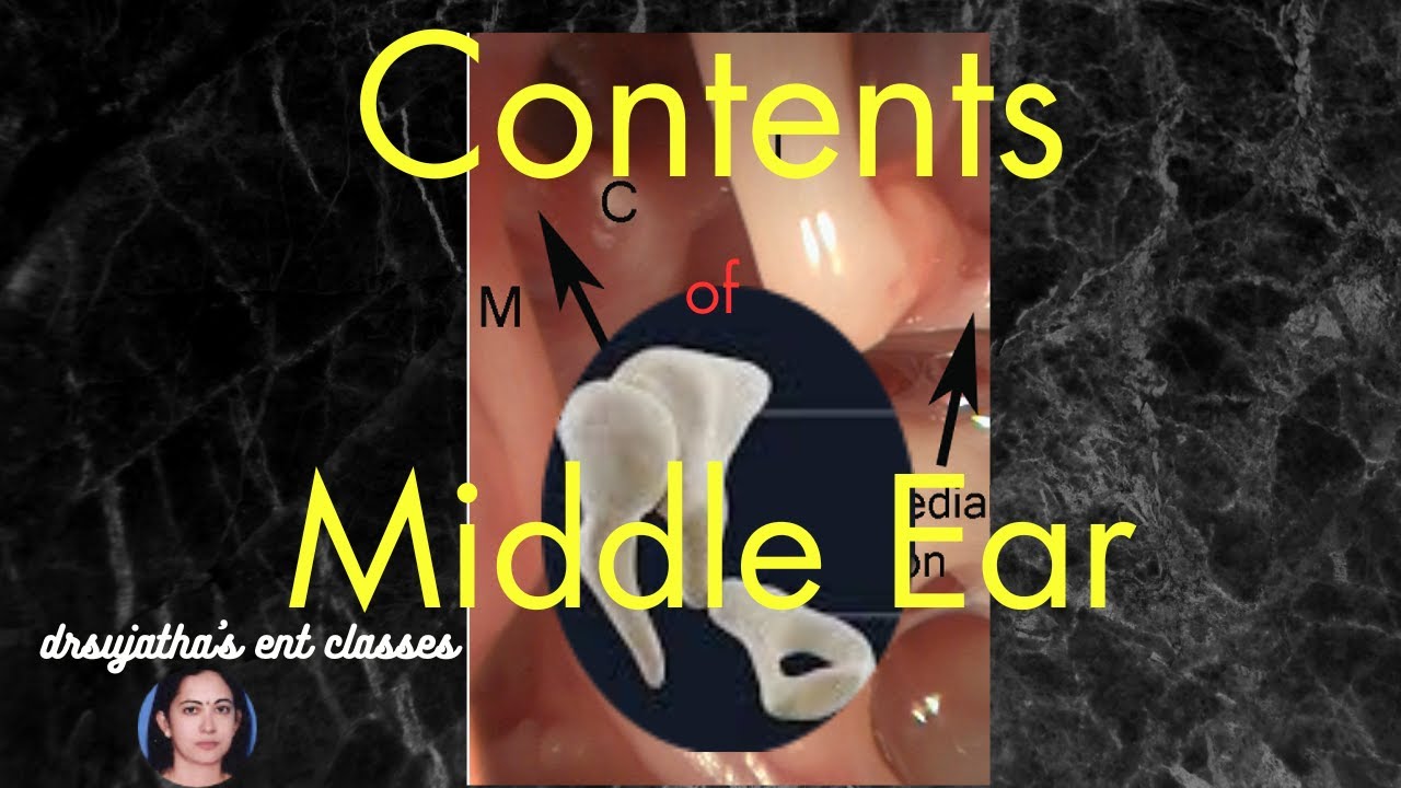 005. Middle Ear Anatomy #Contents of Middle Ear #Boundaries & contents ...