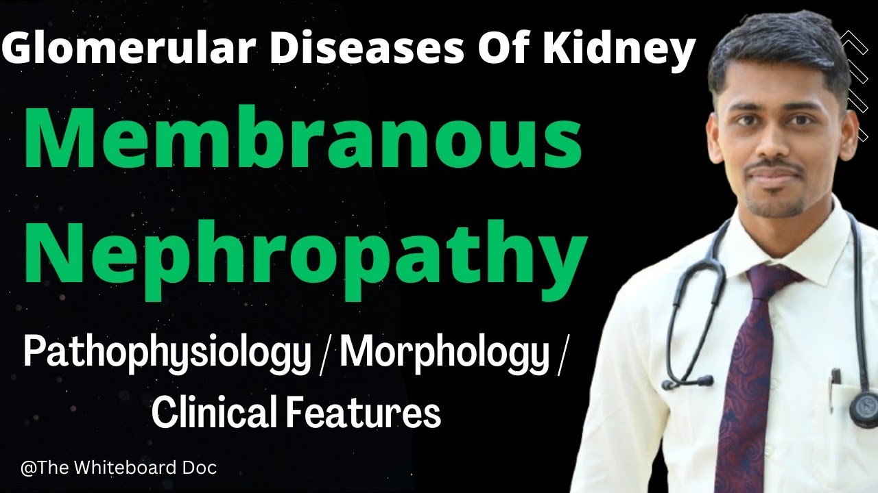 Pathology Of MEMBRANOUS NEPHROPATHY l Nephrotic Syndrome l ...