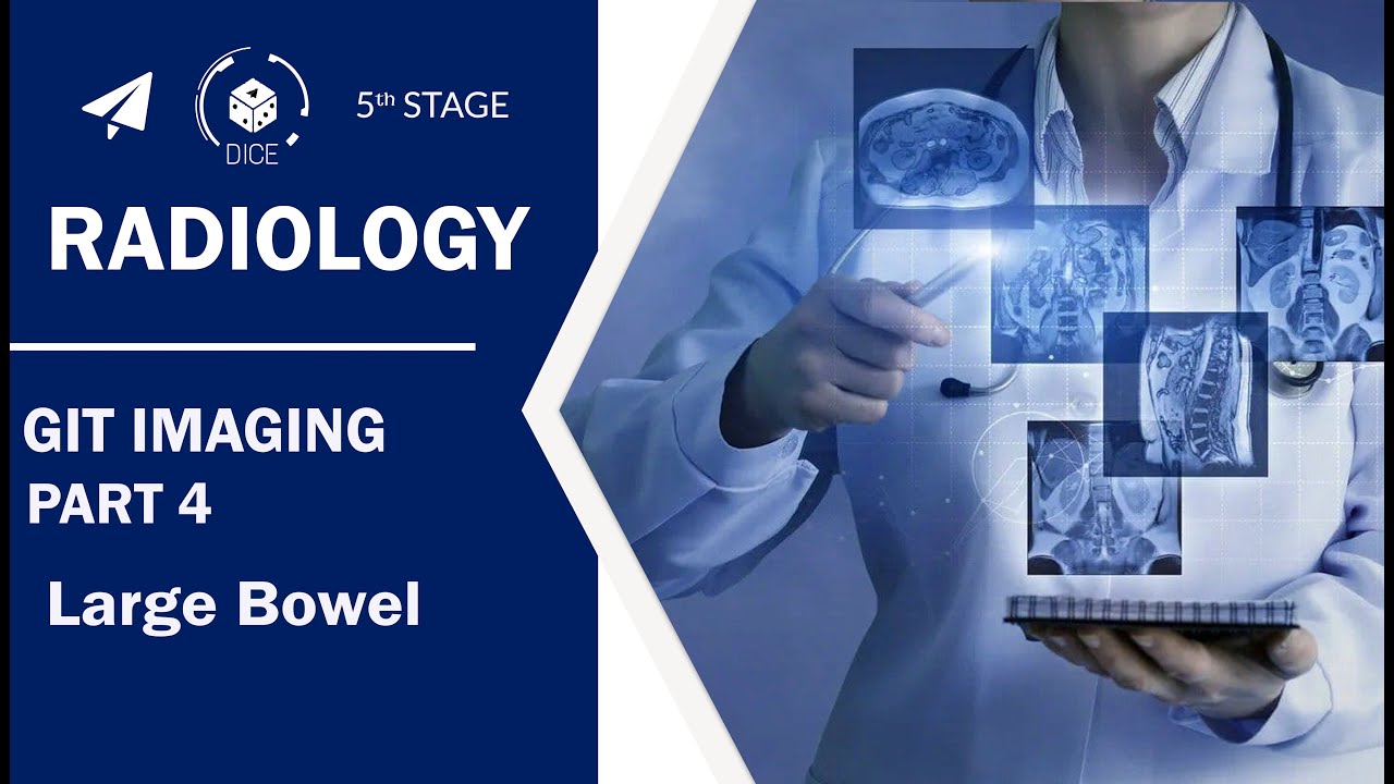 Radiology | GIT Imaging | Part #4 | Large Bowel - YouTube