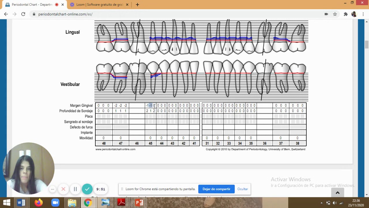 PERIO TOOLS - YouTube