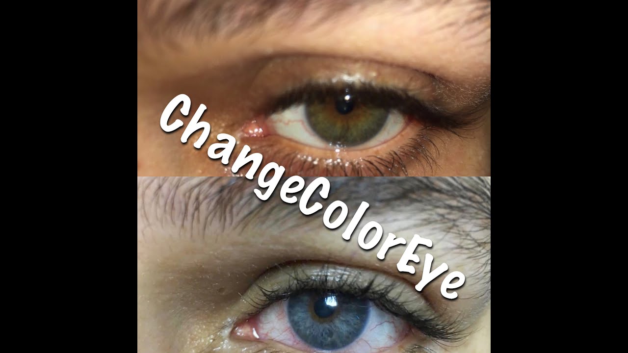 EYE COLOR CHANGE LASER - YouTube