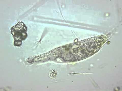 Uroleptus Preying on Heliozoan - YouTube