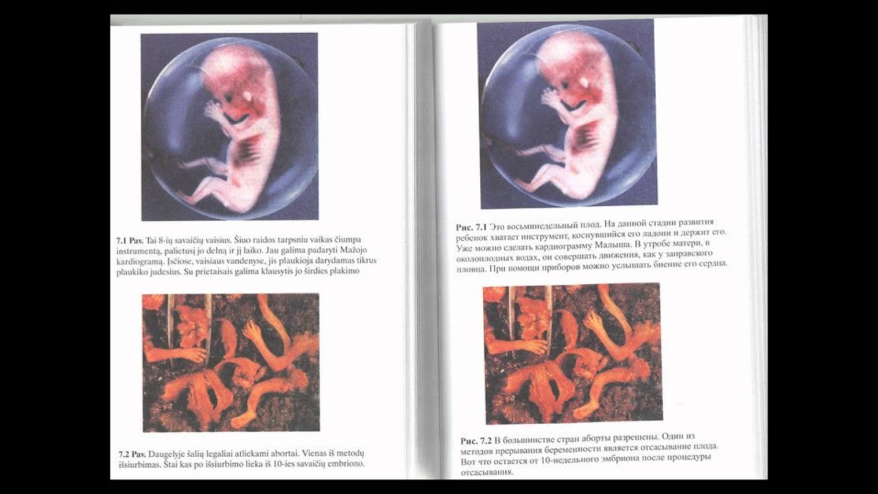 JONAS MARKUNAS -VAIKAI - YouTube