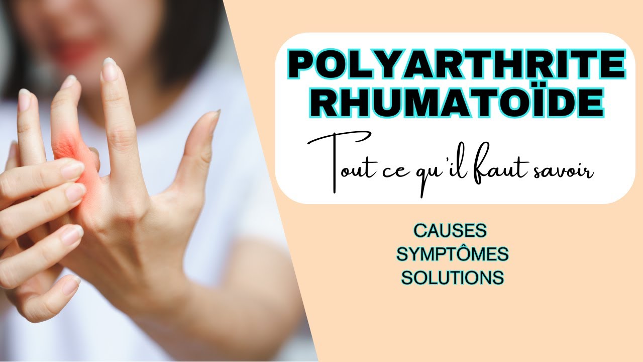 Polyarthrite rhumatoïde, tout ce qu'il faut savoir (causes, symptômes ...
