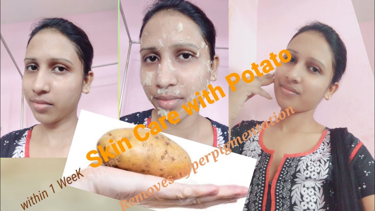 Skin Care WiTh PotaTo/within one Week/removes Hyperpigmentation - YouTube
