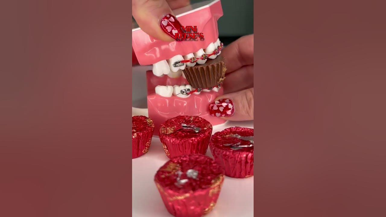 CANDY YOU CAN EAT WITH BRACES CANDY THAT WON T BREAK BRACES VALENTINE candy-you-can-eat-with-braces-candy-that-won-t-break-braces-valentine