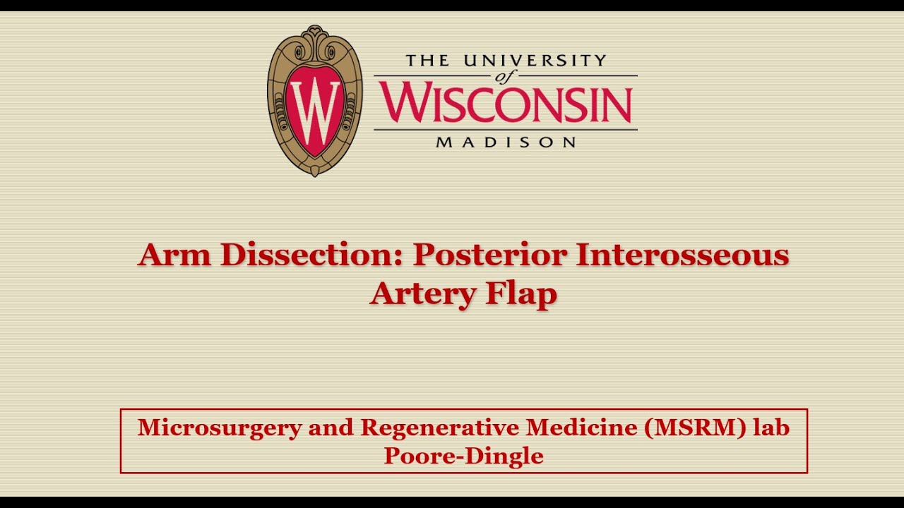 Arm Dissection: Posterior Interosseous Artery Flap - YouTube