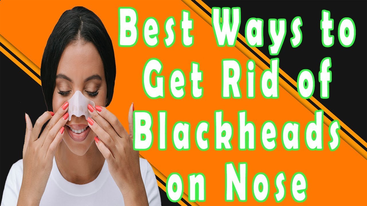 How To Get Rid Of Blackheads On Nose And Face Best Ways To Get Rid Of how-to-get-rid-of-blackheads-on-nose-and-face-best-ways-to-get-rid-of