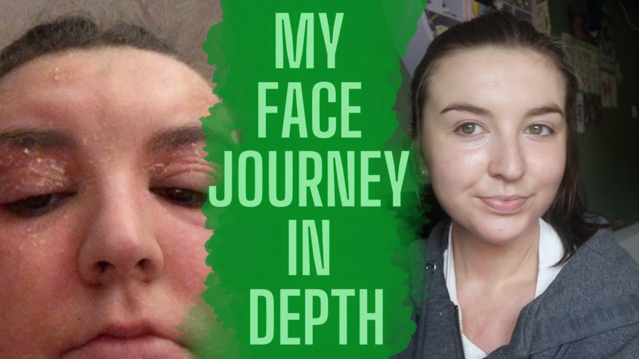 My face journey in depth - YouTube