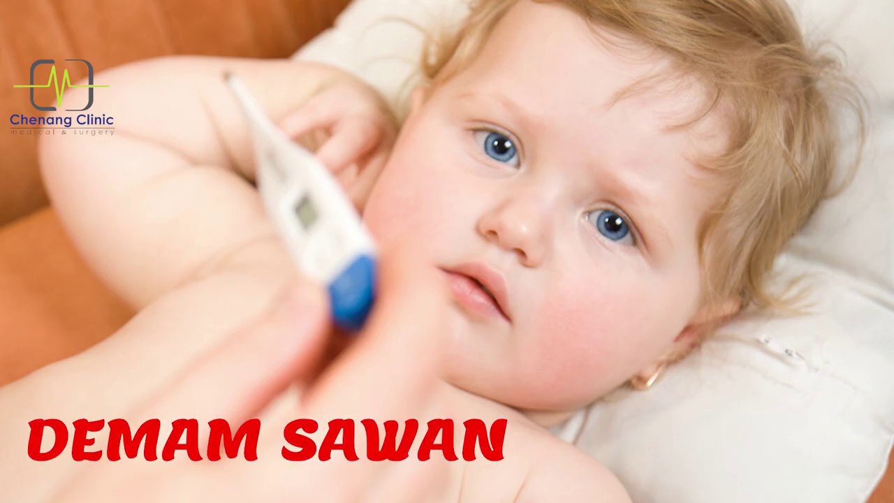 Demam Sawan - YouTube