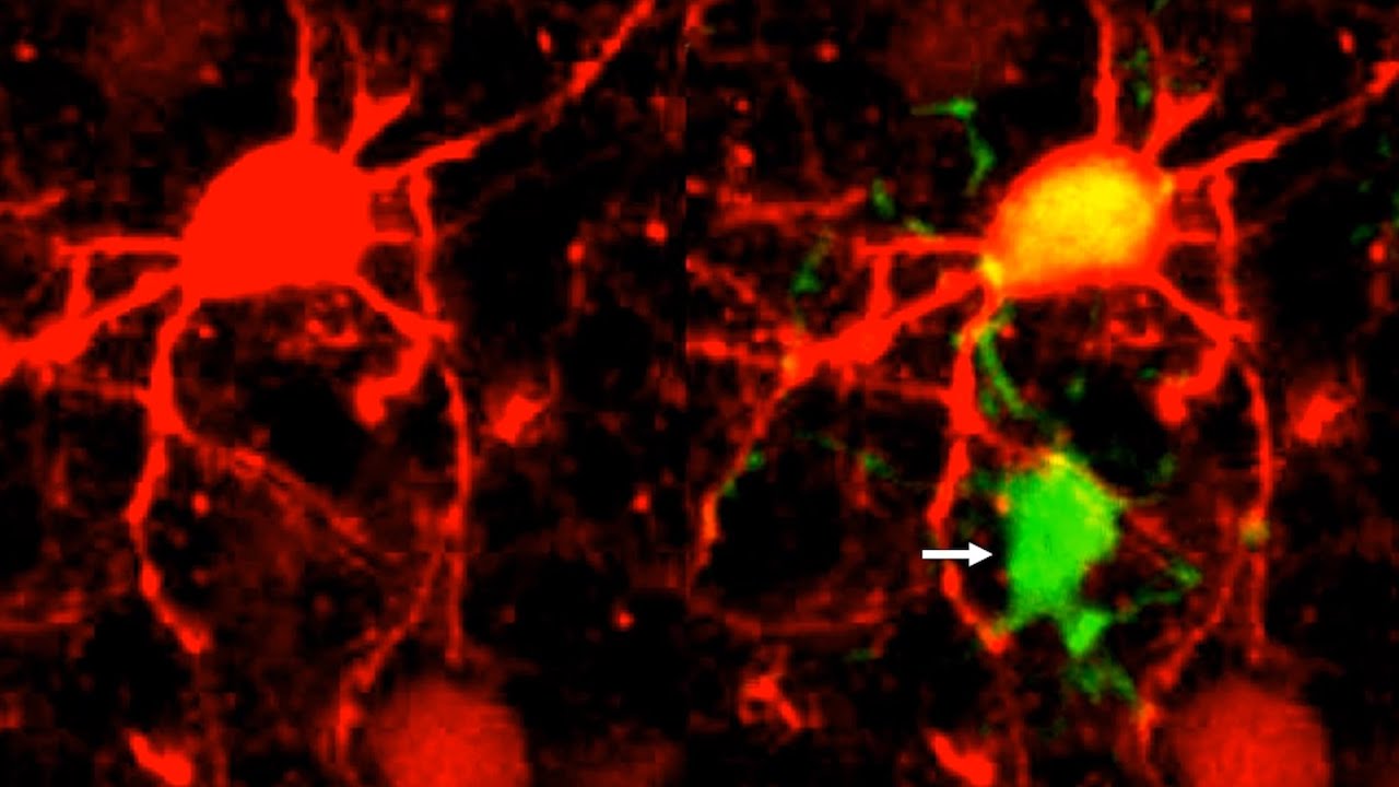 ‘Corpse Removal’ of Dead Cells Captured in Brains For First Time - YouTube