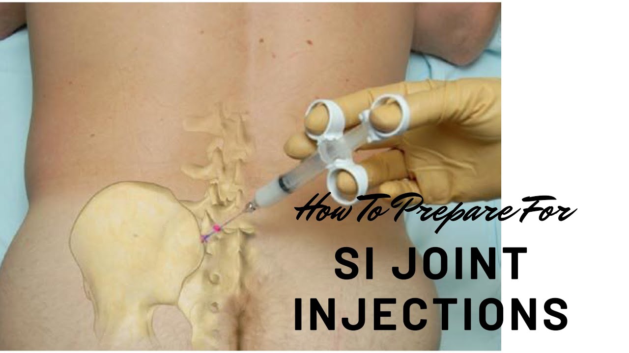 How to prepare for SI Injections with Anesthesia - YouTube