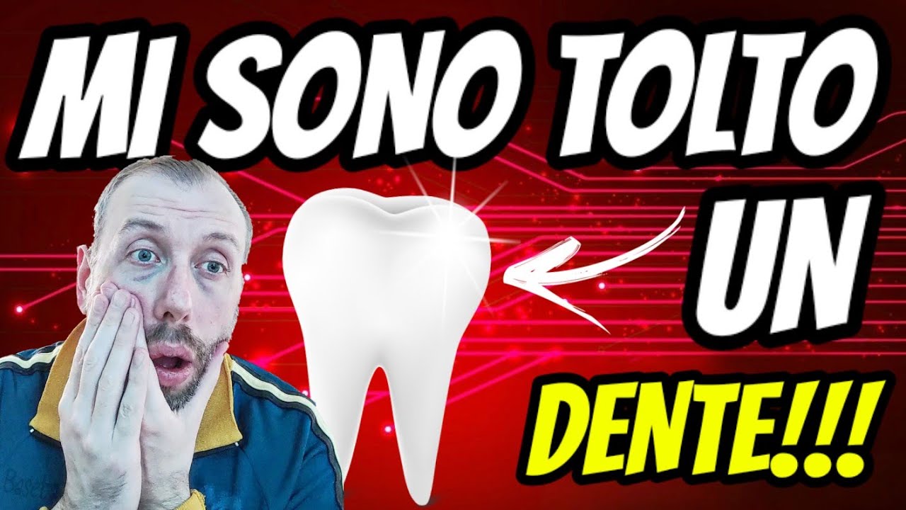MI SONO TOLTO UN DENTE 🦷 CHE DOLORE... 😱 - YouTube
