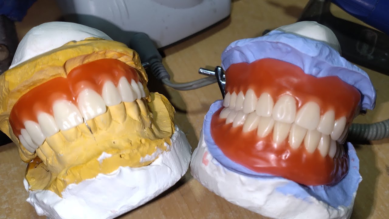 Pustiso sa Pilipinas Denture case Upper and Lower Acrylic denture ...