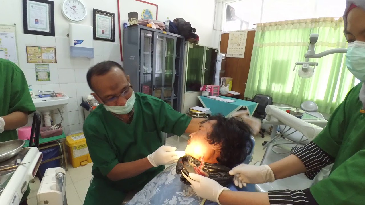 Insisi drainase abses bukal (dental abscces buccal) - YouTube