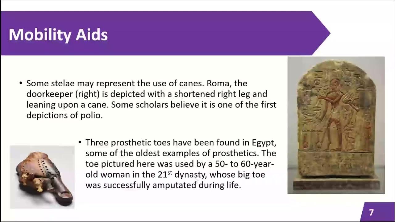 Disability in Ancient Egypt - March 4, 2024 - YouTube