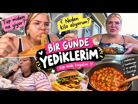 Tüp Midem Neler Yiyor Da kilo alıyorum ! VLOG  | Tam gerçek beslenme 😋