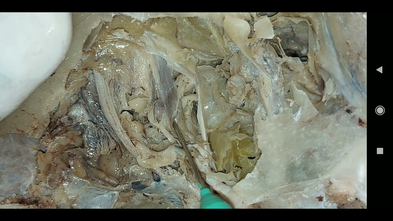 Levator palpebrae superioris | Oculomotor nerve |Elevation of upper ...