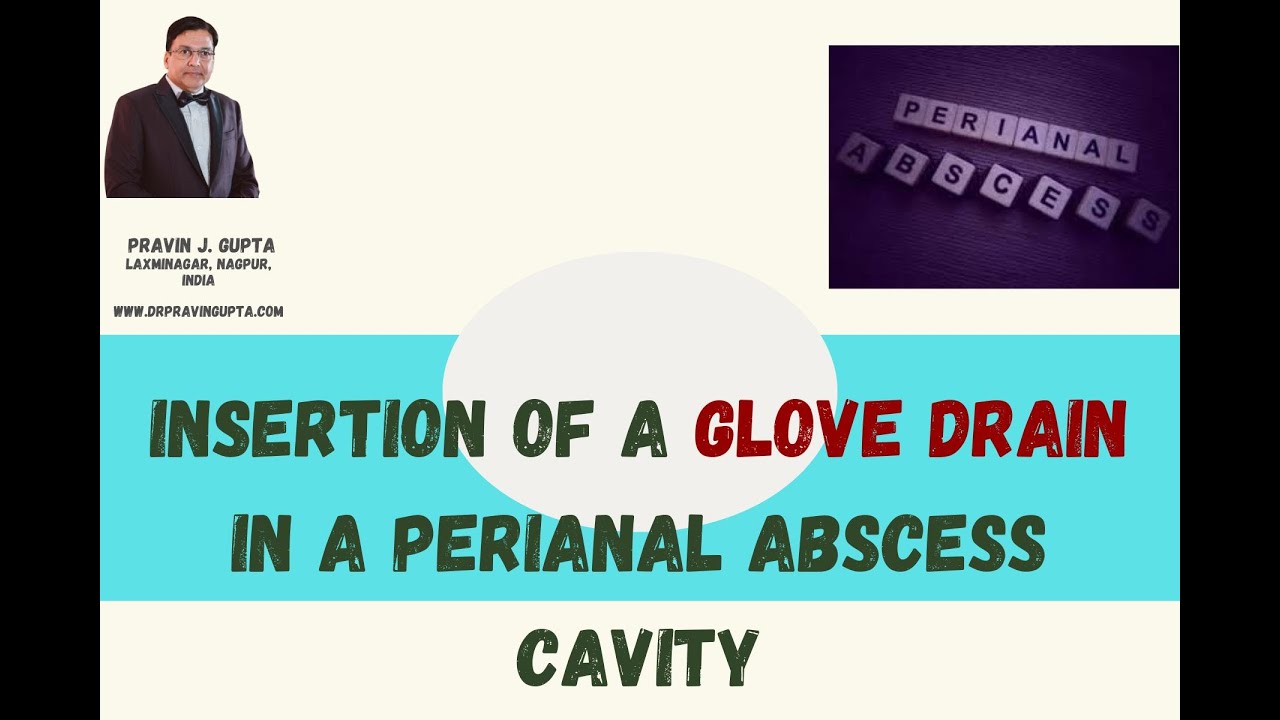 DRAINING A PERIANAL ABSCESS AND PUTTING A GLOVE DRAIN - YouTube