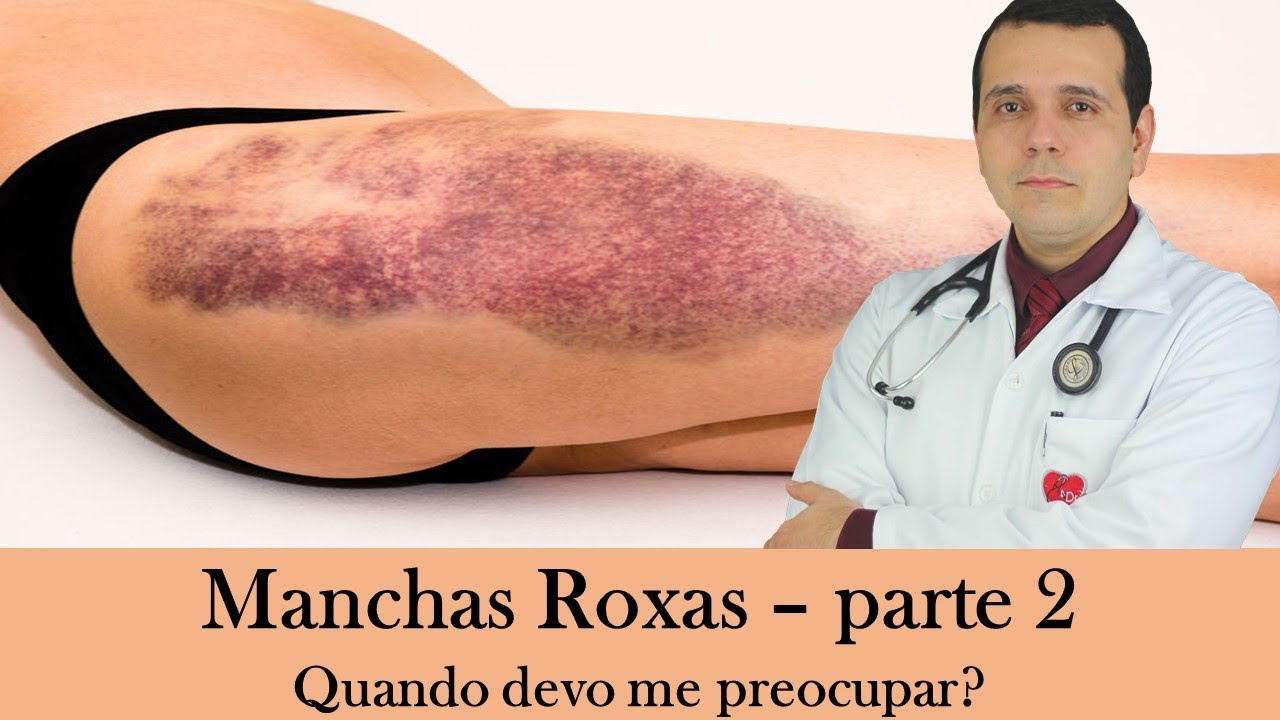 Manchas Roxas Na Coluna Vertebral - RETOEDU