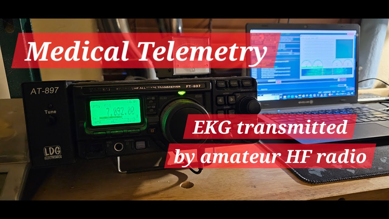 Medical Telemetry by Amateur Radio - YouTube
