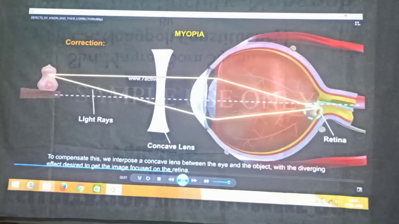 Defects of vision - YouTube