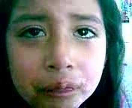 mi prima con varicel desesperada