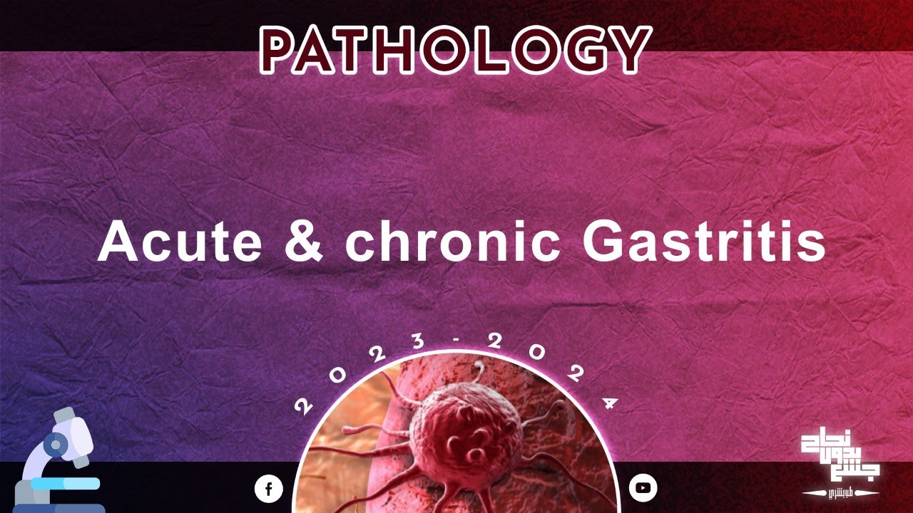 L2 part 1, Acute and chronic gastritis, Pathology - YouTube