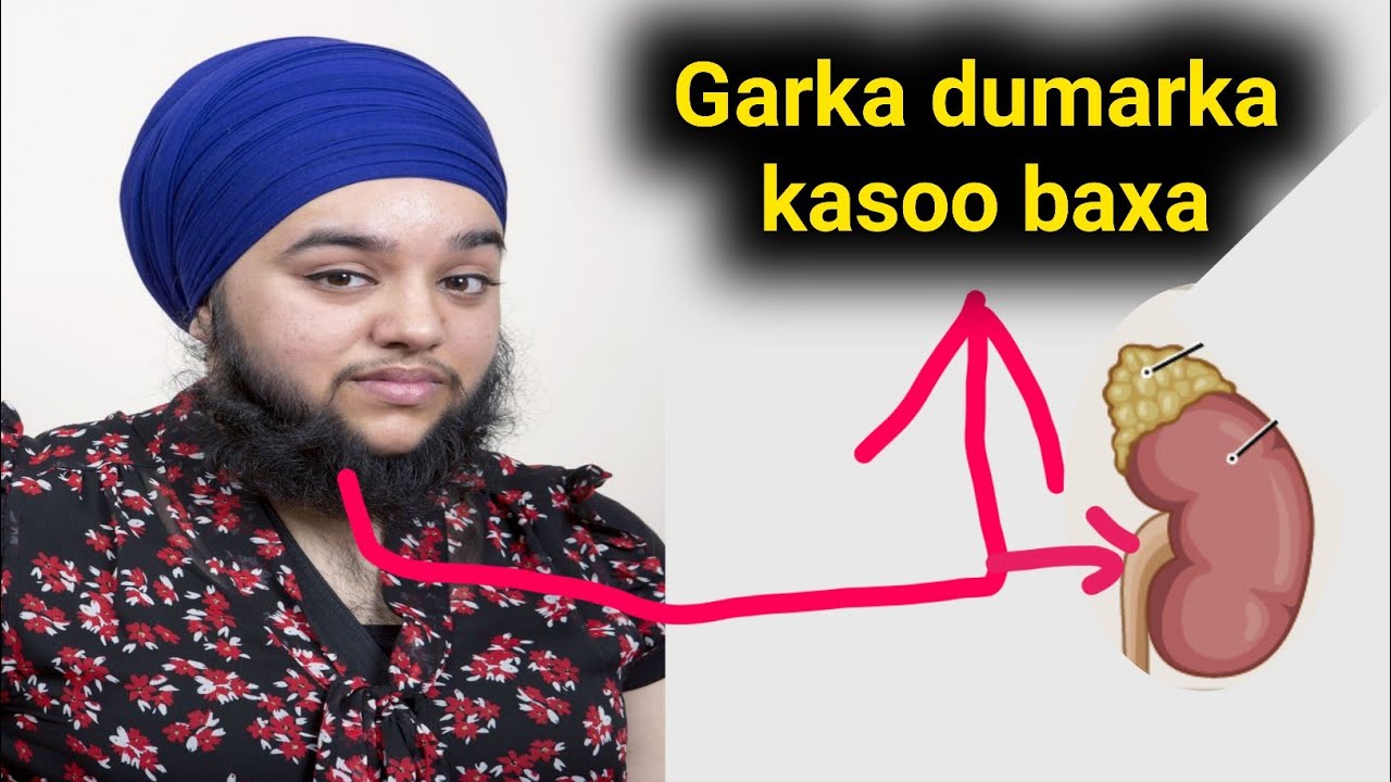 Timaha garka uga Soo baxa dumarka 5- Sheey oo sababta iyo qaladaadka ...