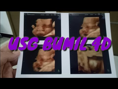 USG Bumil 4D
