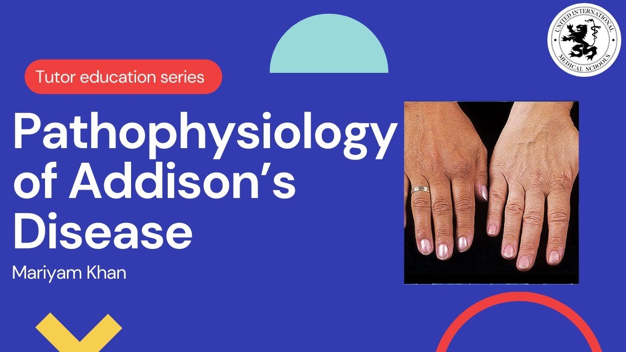 Pathophysiology of Addison’s Disease - YouTube