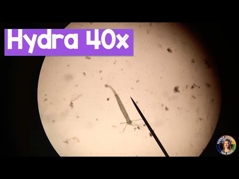 Hydra Under Microscope 40x