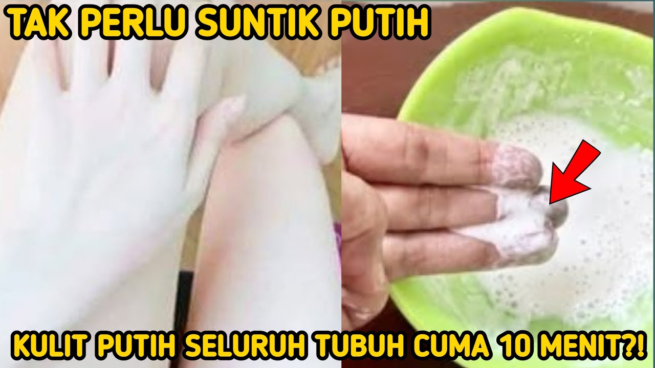 TAK PERLU SUNTIK PUTIH!! KULIT PUTIH PERMANEN DALAM 10 MENIT ...