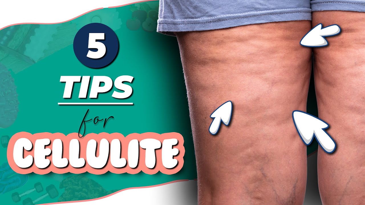 How to get RID of CELLULITE? || Simple HOME remedies - YouTube