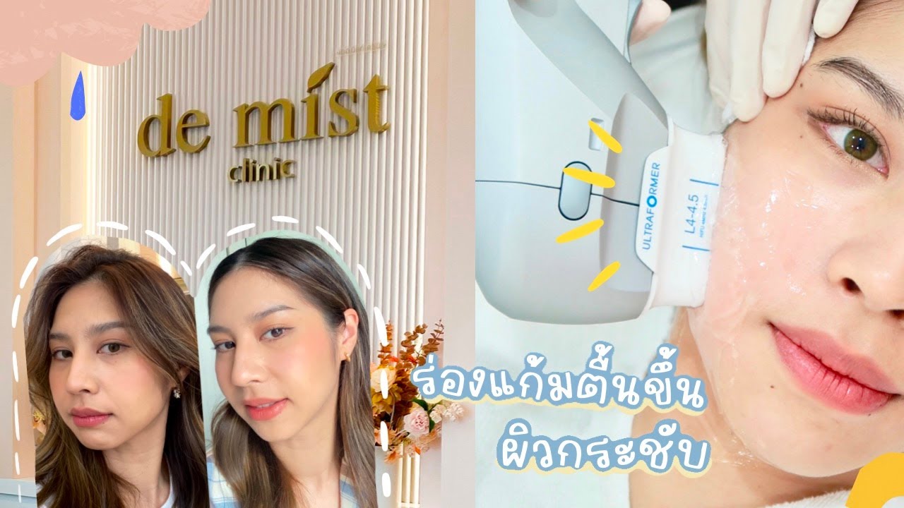 Ultraformer + Botox ผลลัพธ์จึ้งมาก ! ร่องแก้มตื้น หน้ากระชับ ผิวดูเด็ก ...