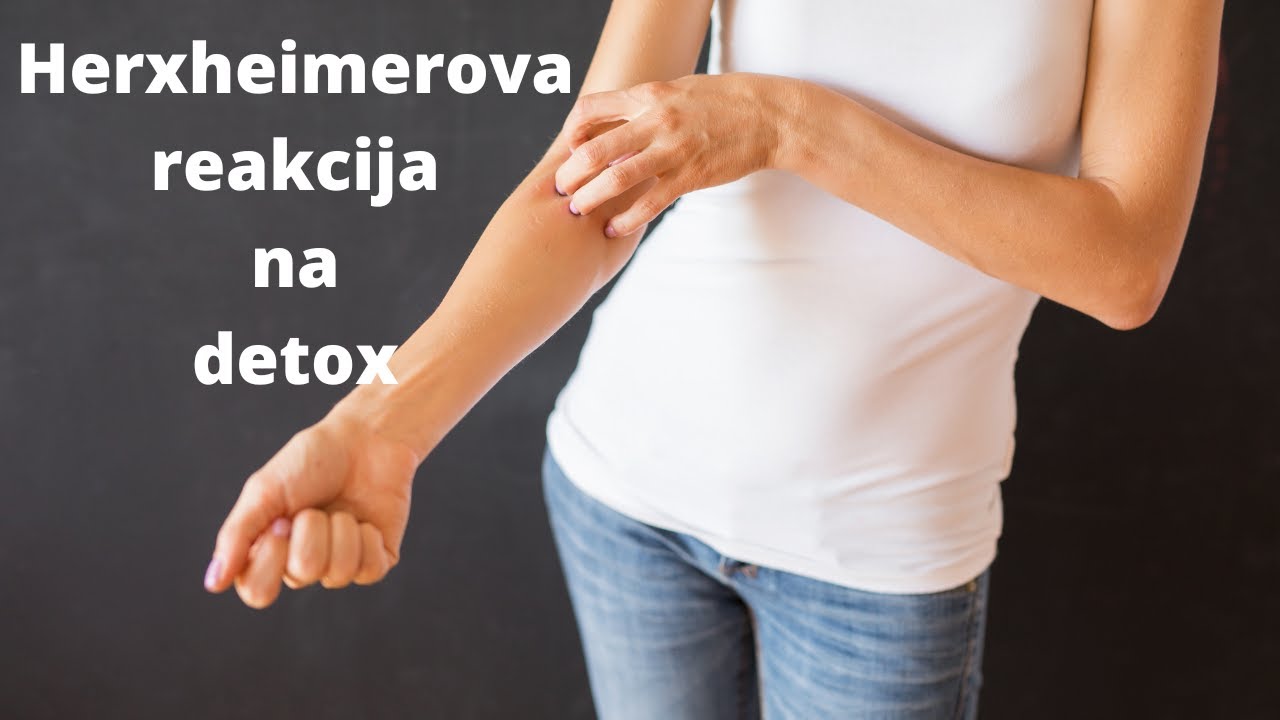 Herx reakcija - reakcija na detox - YouTube