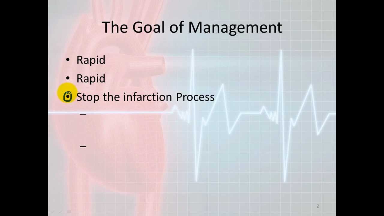 12 Lead Interpretation Part 7: Management of MI - YouTube