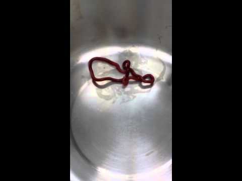 Kidney worm - YouTube