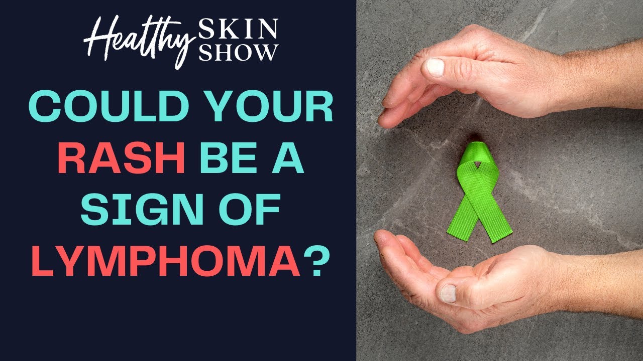 Could Your Rash Be A Sign Of LYMPHOMA? | Dr. Peter Lio - YouTube