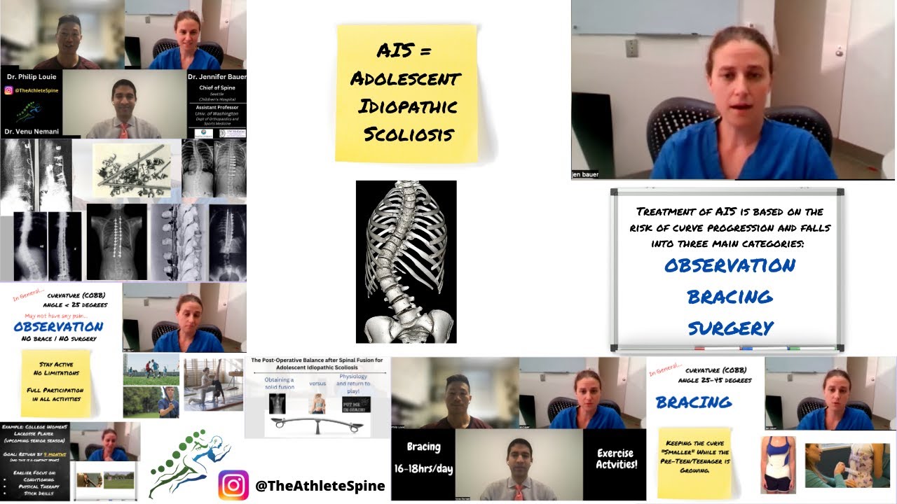 Returning to Sports with Adolescent Idiopathic Scoliosis - Guest: Dr ...