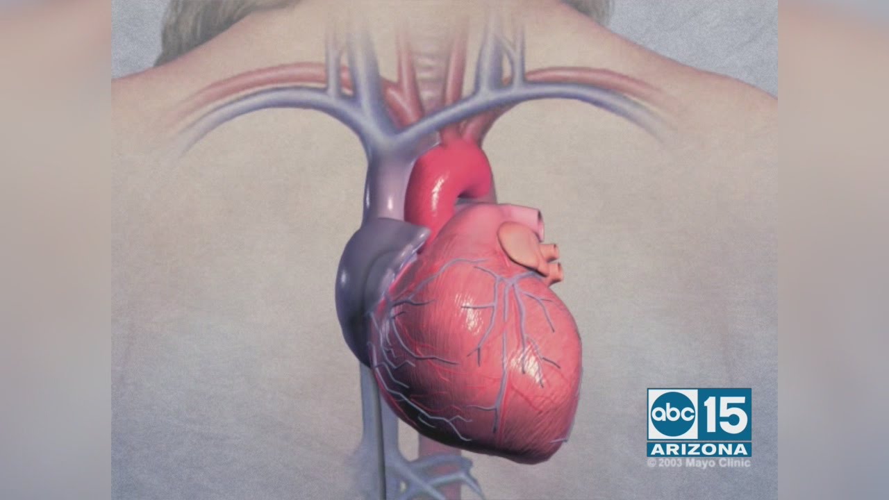 Mayo Clinic shares new treatment options for atrial fibrillation - YouTube