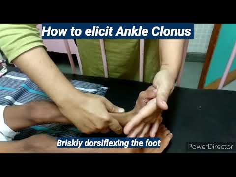 Ankle Clonus I Pediatrics - YouTube