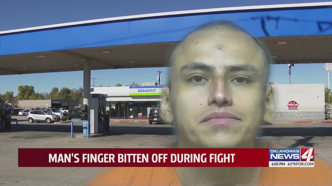 Man's finger bitten off during fight - YouTube