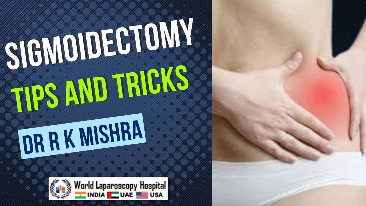 Tips and Tricks for Safe Laparoscopic Sigmoidectomy | Step-by-Step ...