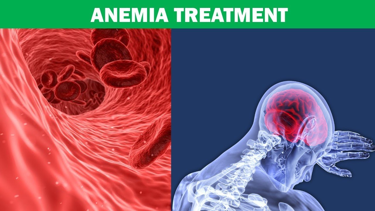 The Role of Iron, Vitamin B12 and Red Blood Cells in Anemia ...