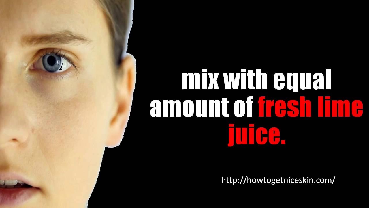 How To Get Rid Of Pimples On Chin Fast Naturally At Home YouTube how-to-get-rid-of-pimples-on-chin-fast-naturally-at-home-youtube