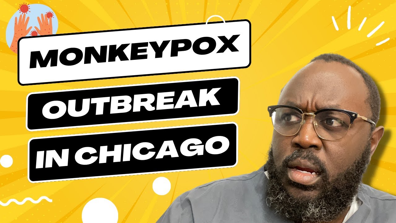 Doctor Reacts to Monkeypox Outbreak in Chicago - YouTube